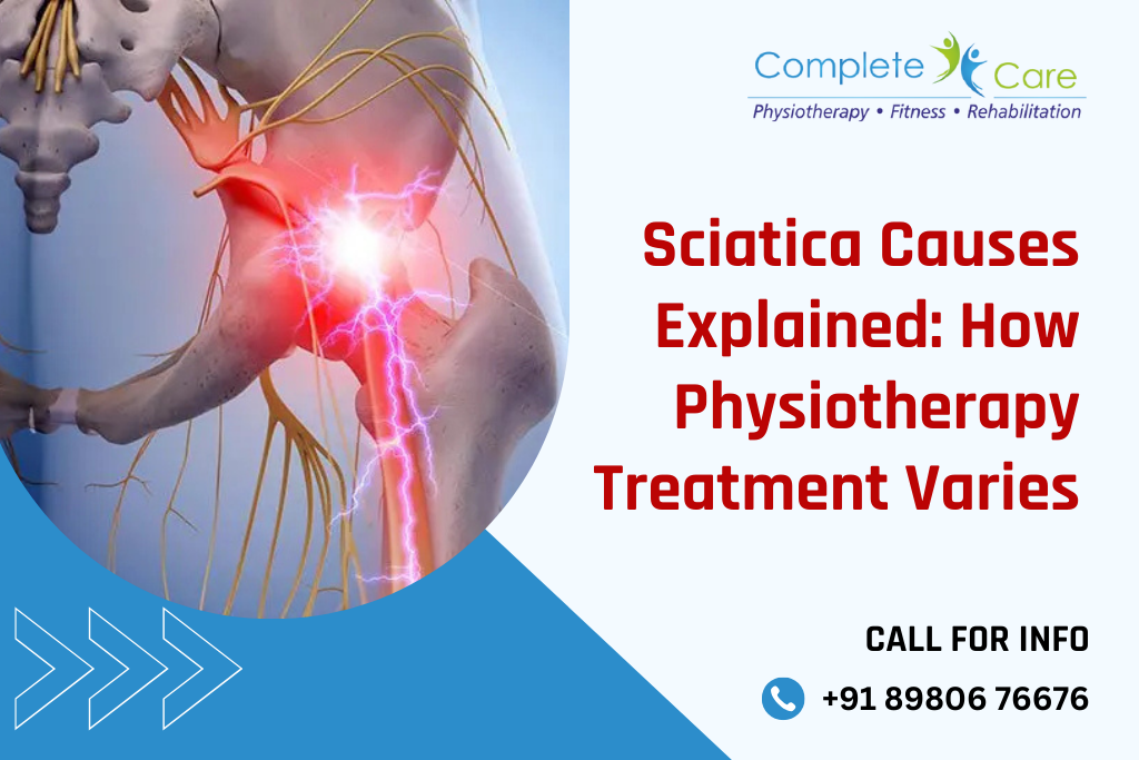 Sciatica Causes Explained: How Physiotherapy Treatment Varies